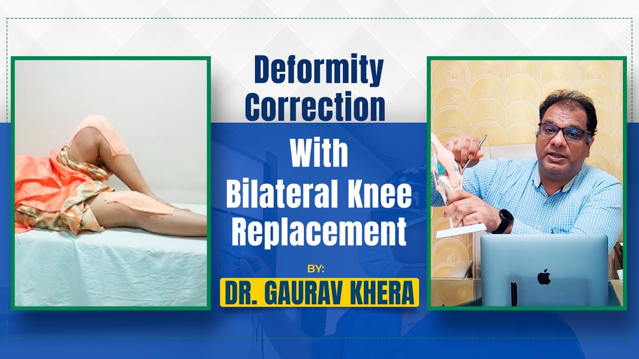 Bilateral ( Double ) Knee Replacement Surgery | Deformity Correction in ...