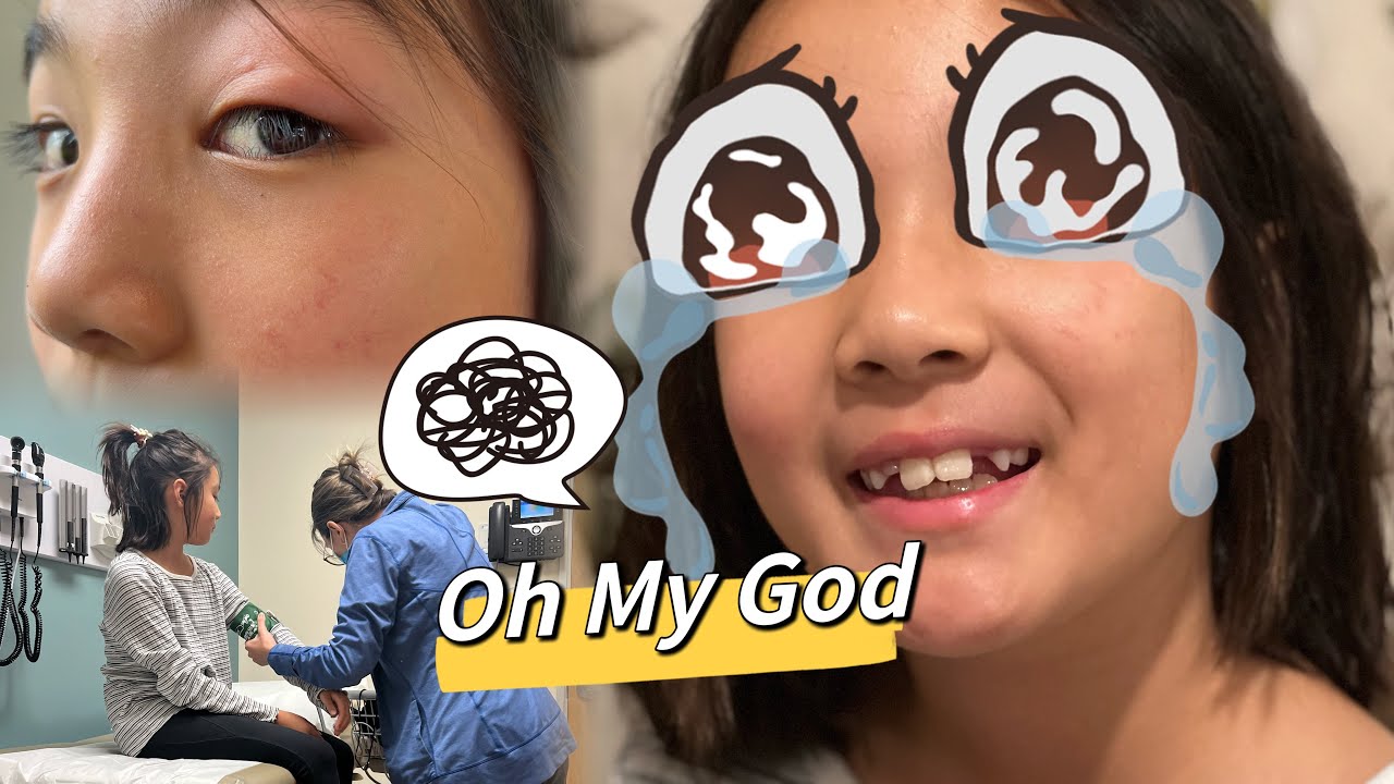 GoGo BoBa | What happened to my eye? 👀| 012 - YouTube