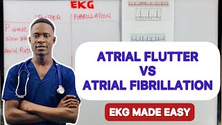 How to read EKG P5 | Atrial Flutter and Atrial Fibrilla... | Doovi