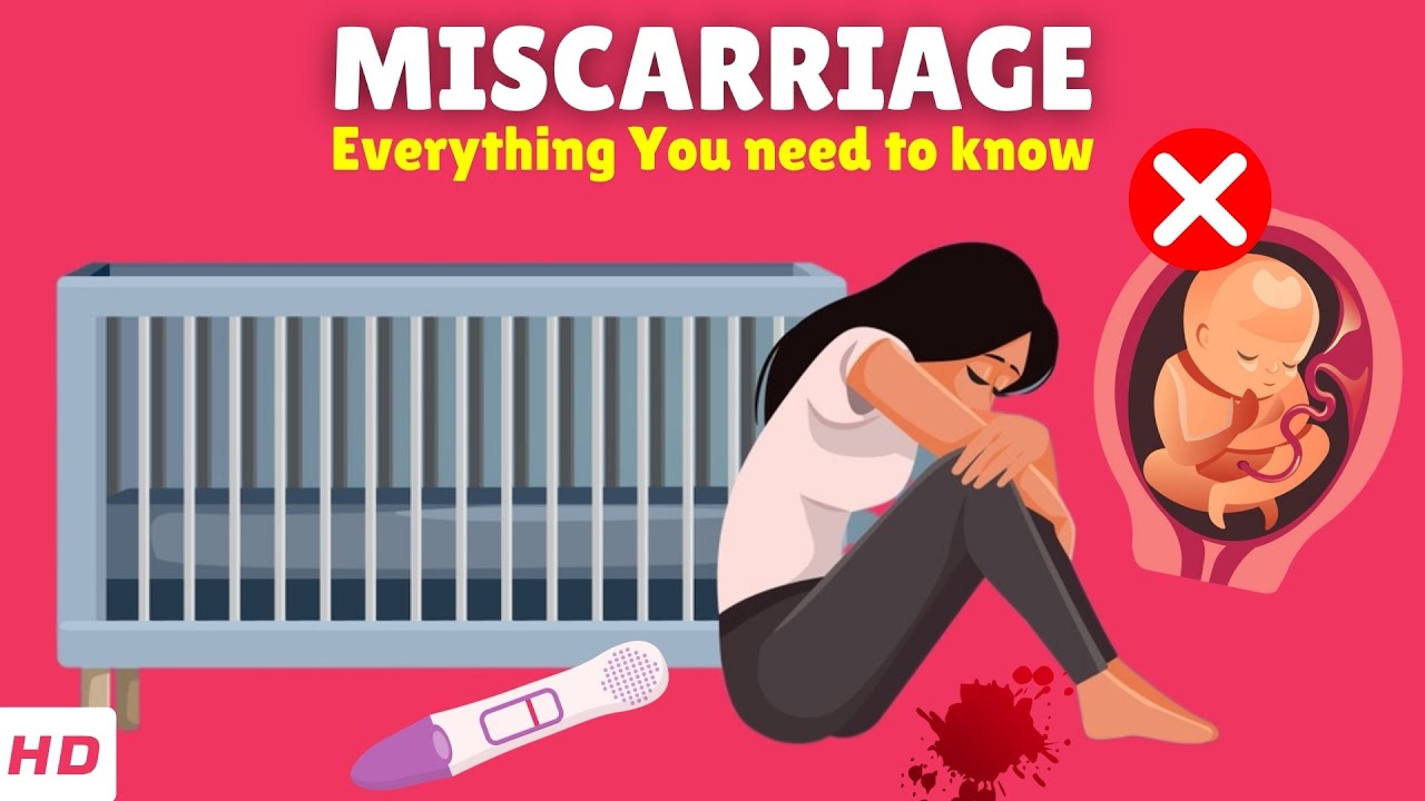 Miscarriage – Causes, Signs and Symptoms, Diagnosis, Treatment ...