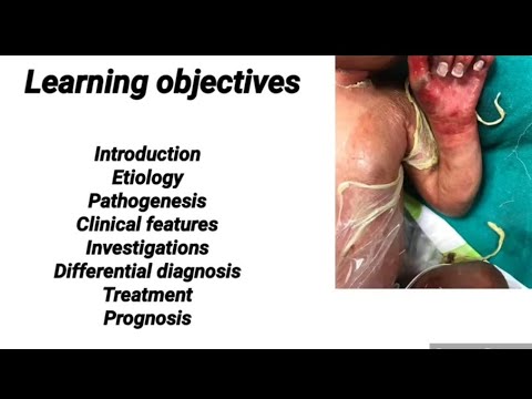 Staphylococcal Scalded Skin Syndrome | SSSS | Pediatrics - YouTube