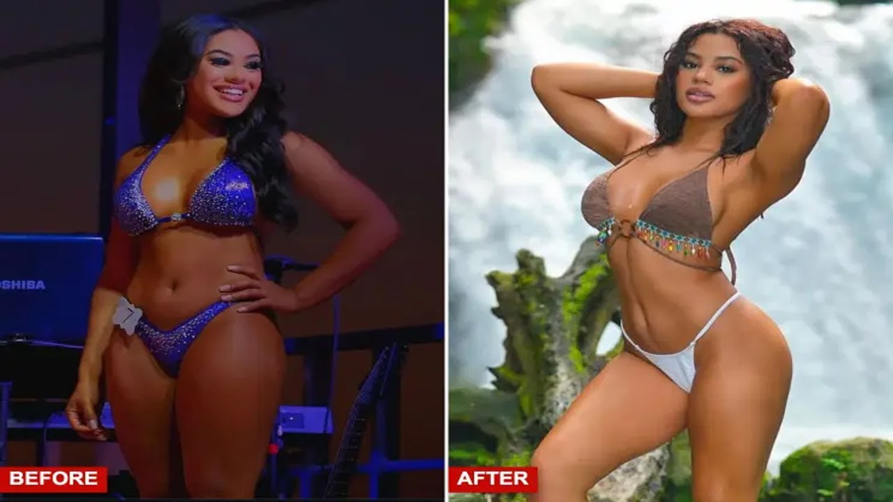 'Face BBLs' Fix Ozempic Side Effect: People Spend Thousands to Restore Confidence. - YouTube