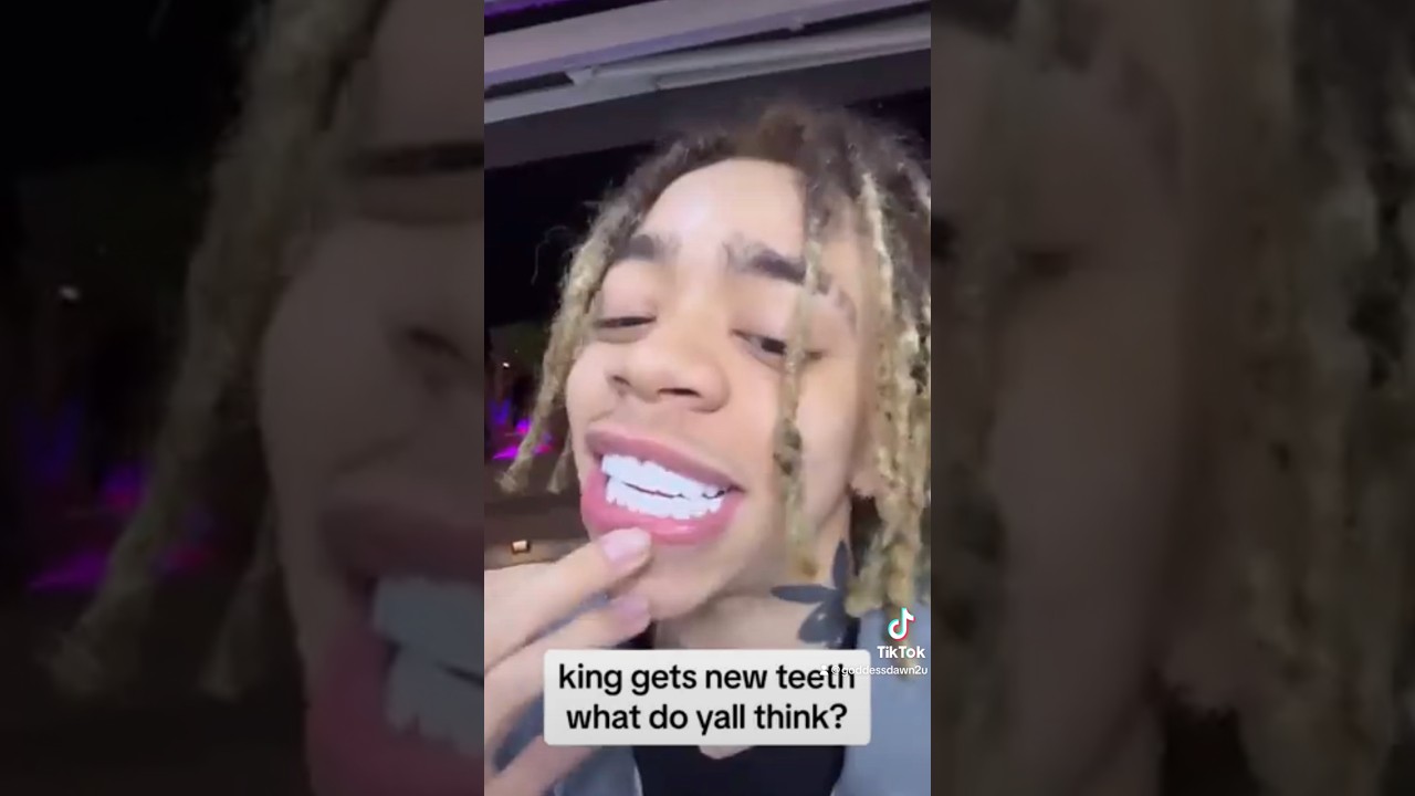 King Harris Shows off his New Teeth! 😳 - YouTube