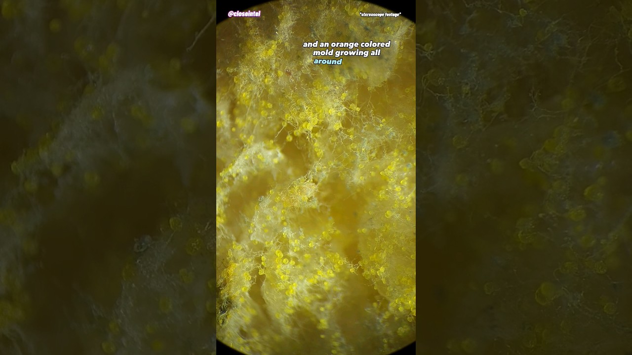Moldy Bread Under Microscope #microbiology - YouTube