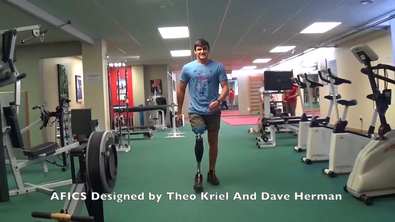 Adaptive Flexible Ischial Containment socket - YouTube