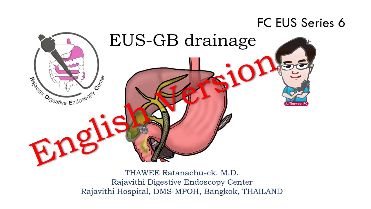 EUS Series 6 GBD English Version - YouTube
