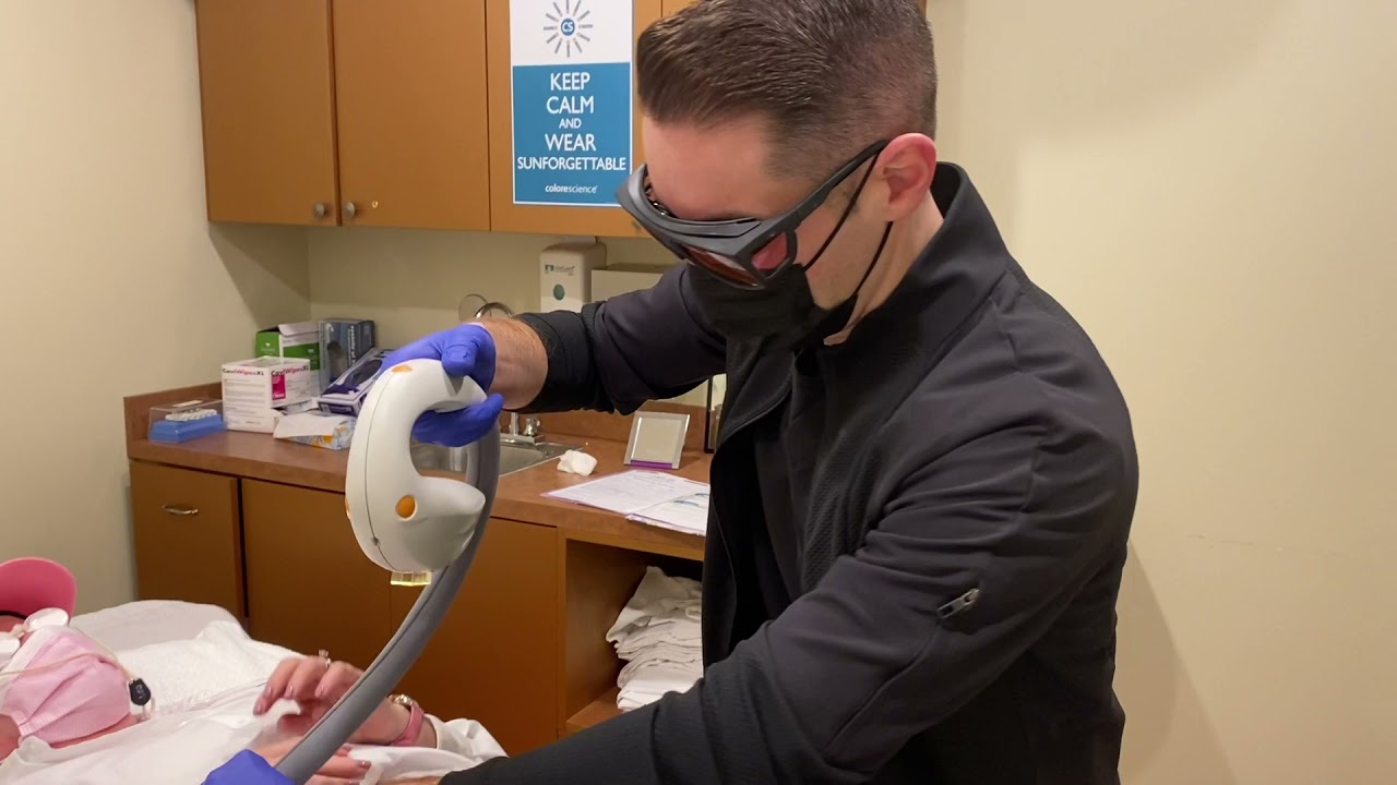 IPL Treatment on Abdomen Scar - YouTube