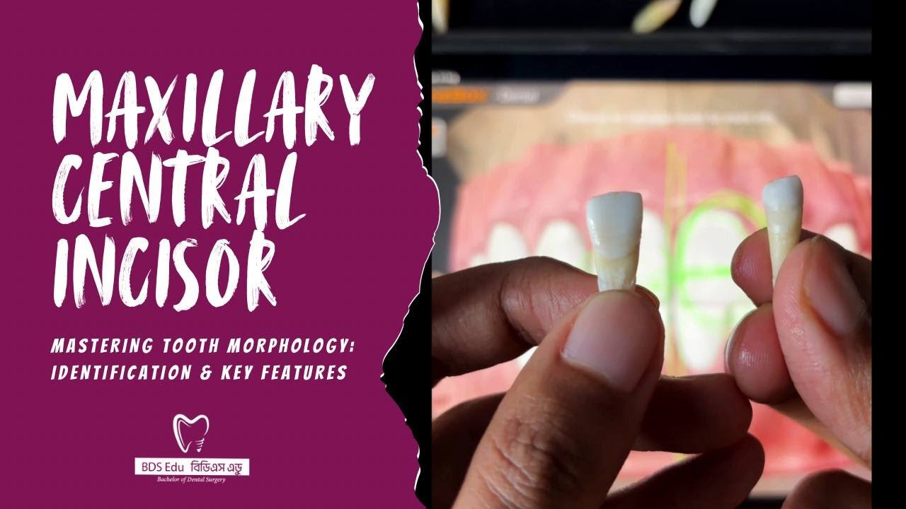 Maxillary Central Incisor | Mastering Tooth Morphology | S M Reaj ...