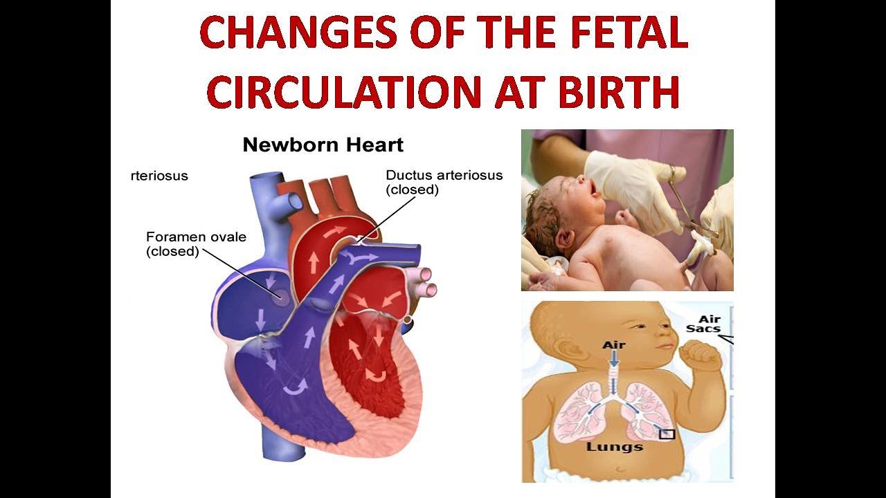 CHANGES OF THE FETAL CIRCULATION AT BIRTH - YouTube