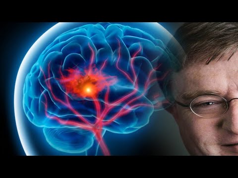 Counter-Stroke - YouTube