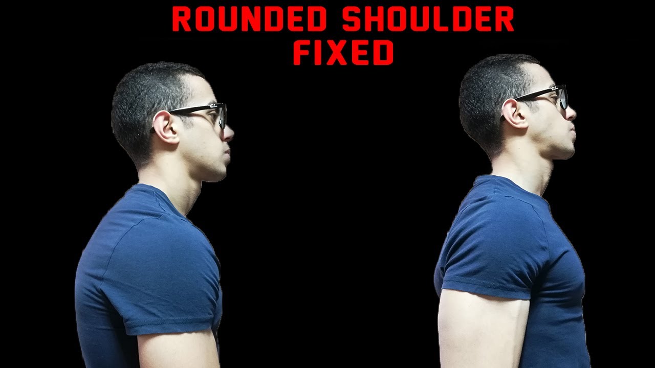 How to fix rounded shoulders (ANATOMY AND EXERCISES EXPLAINED) (SUB ENG ...