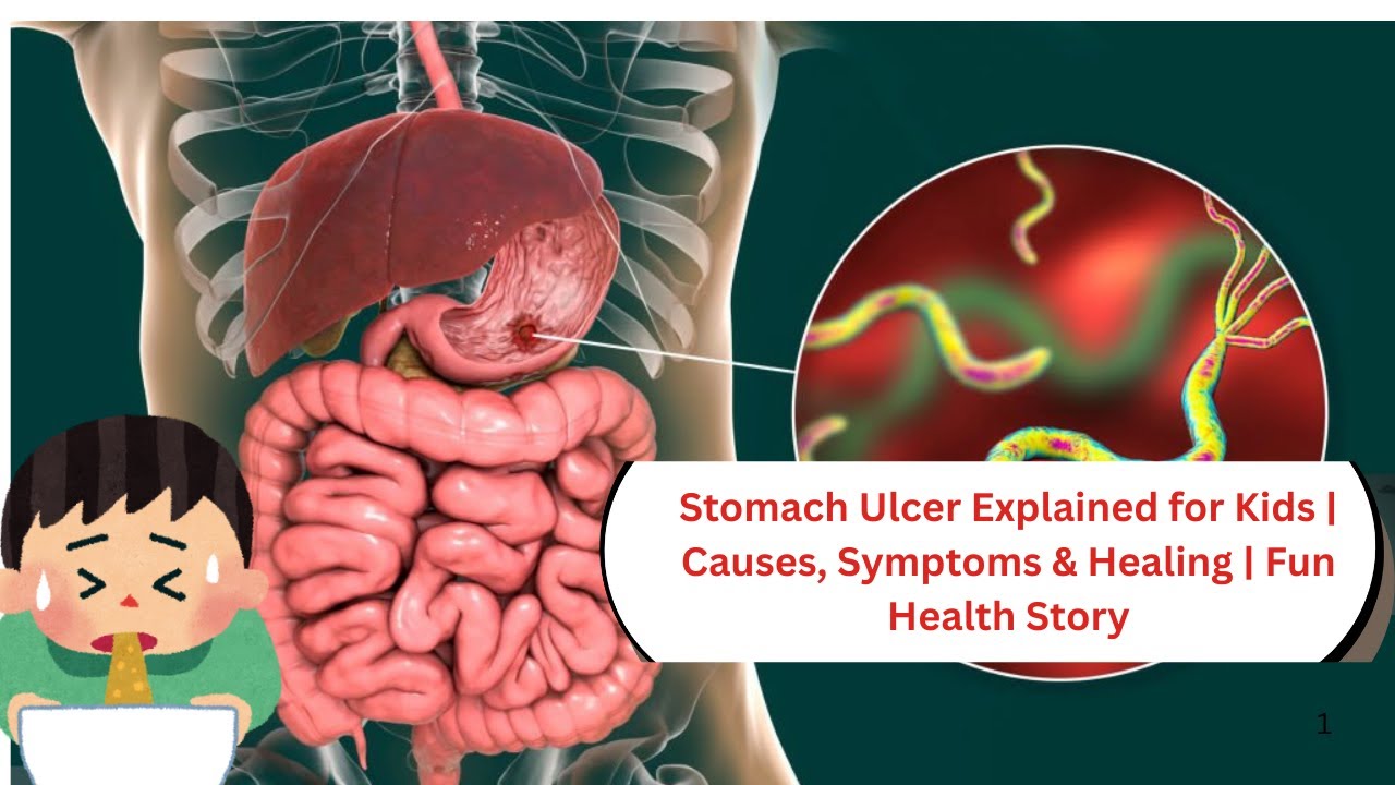 Stomach Ulcer Explained for Kids | Causes, Symptoms & Healing | Fun ...
