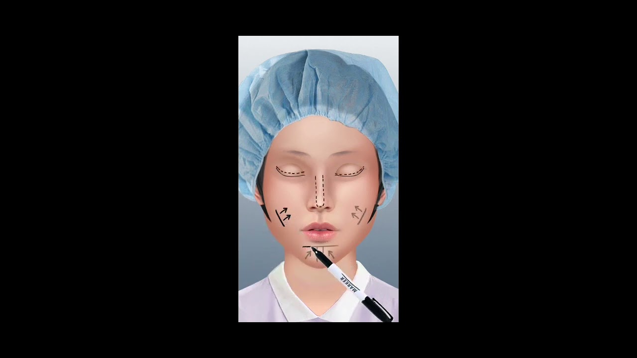 Asmr Care Animation Collection5 Deep Cleansing Removing Earwax