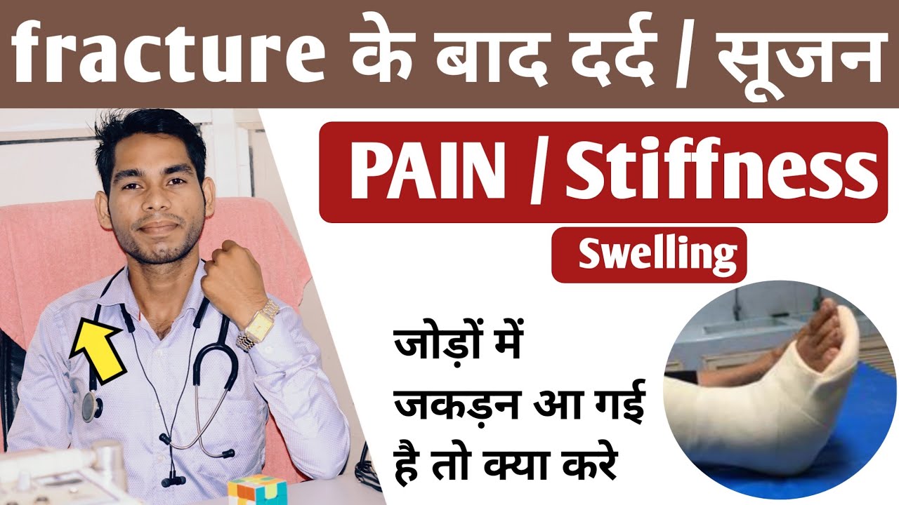 fracture plaster ke bad Hath pair ankle me sujan, sujan kaise kam kare ...