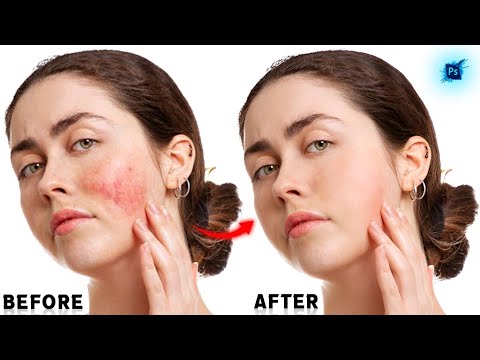 how to remove red spots on face in photoshop | how to remove red face ...