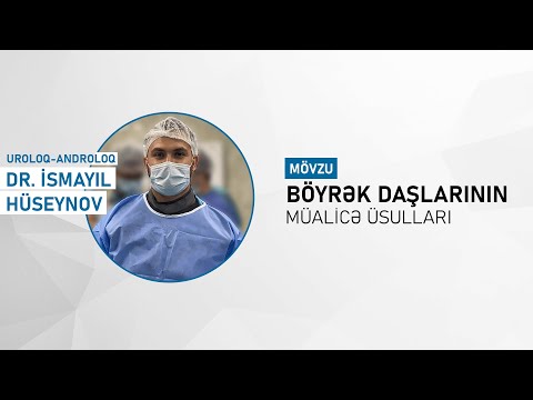 Böyrək daşlarının müalicə üsulları | Uroloq Androloq Dr. İsmayıl Hüseynov