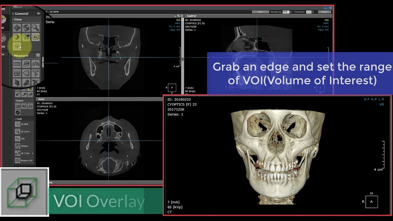 How to: Use General Tools on OnDemand3D - YouTube