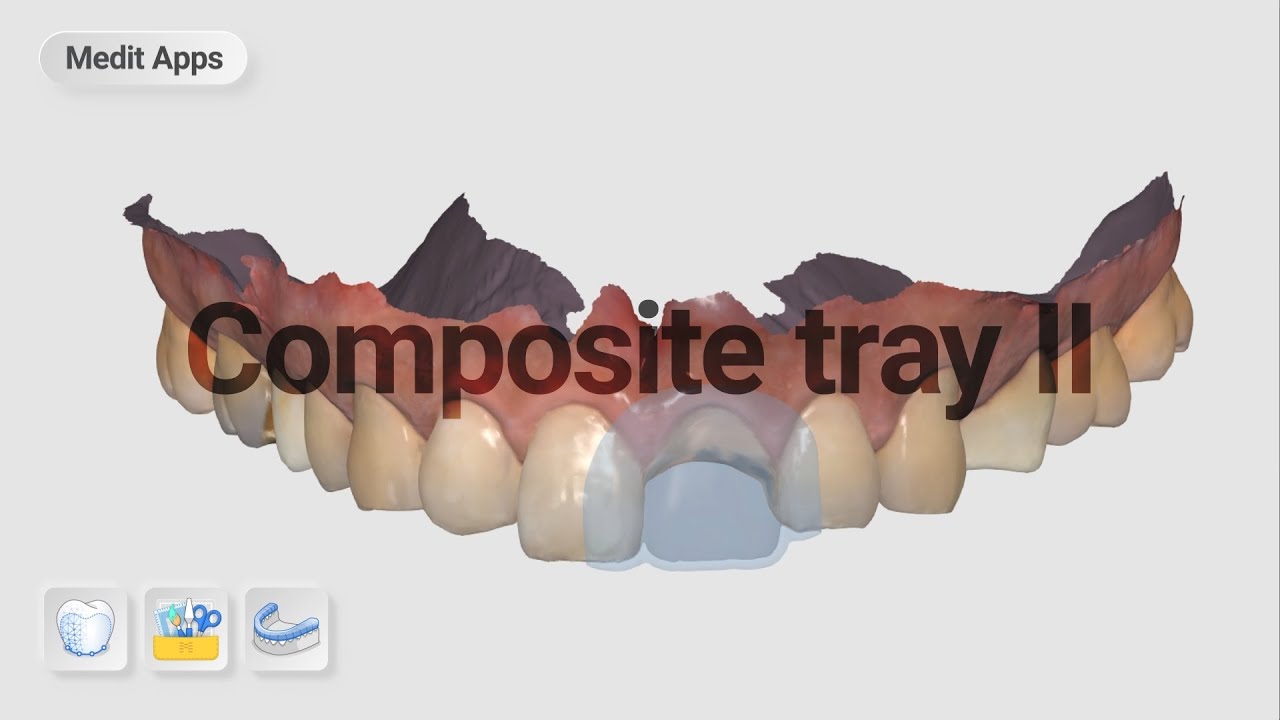 Designing a composite resin tray for missing teeth. - YouTube