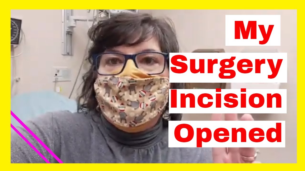 My breast surgery incision opened at home - YouTube