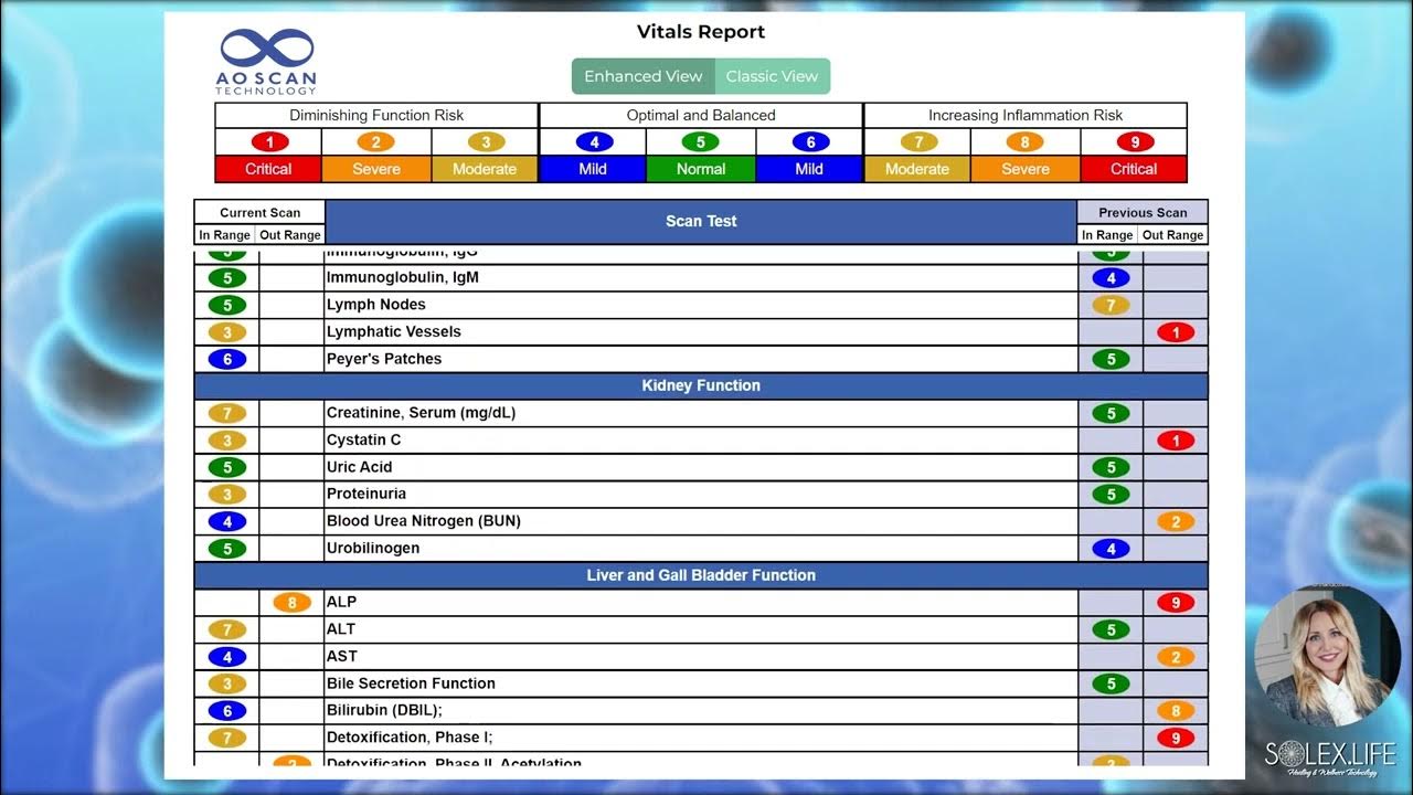 01 AO SCAN VITAL SCAN REPORT SOLEX LIFE - YouTube