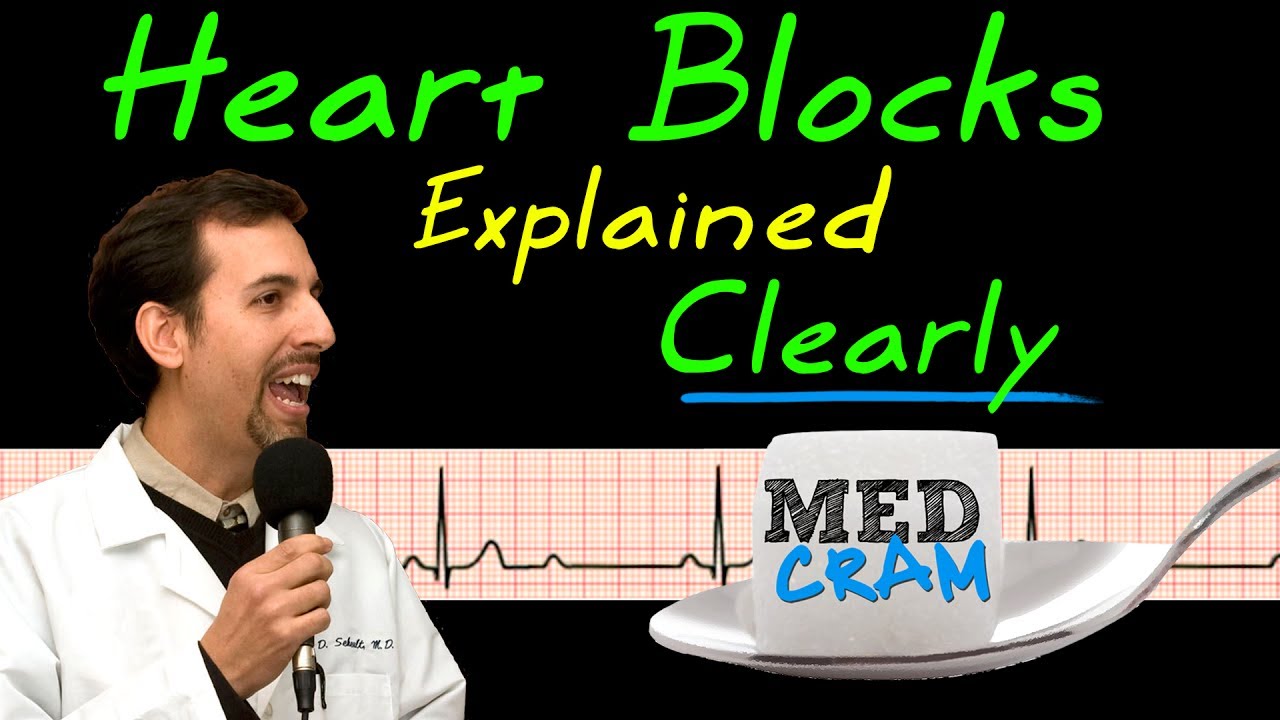 Heart Blocks On EKG ECG Explained Clearly MedCram EKG ECG Course heart-blocks-on-ekg-ecg-explained-clearly-medcram-ekg-ecg-course
