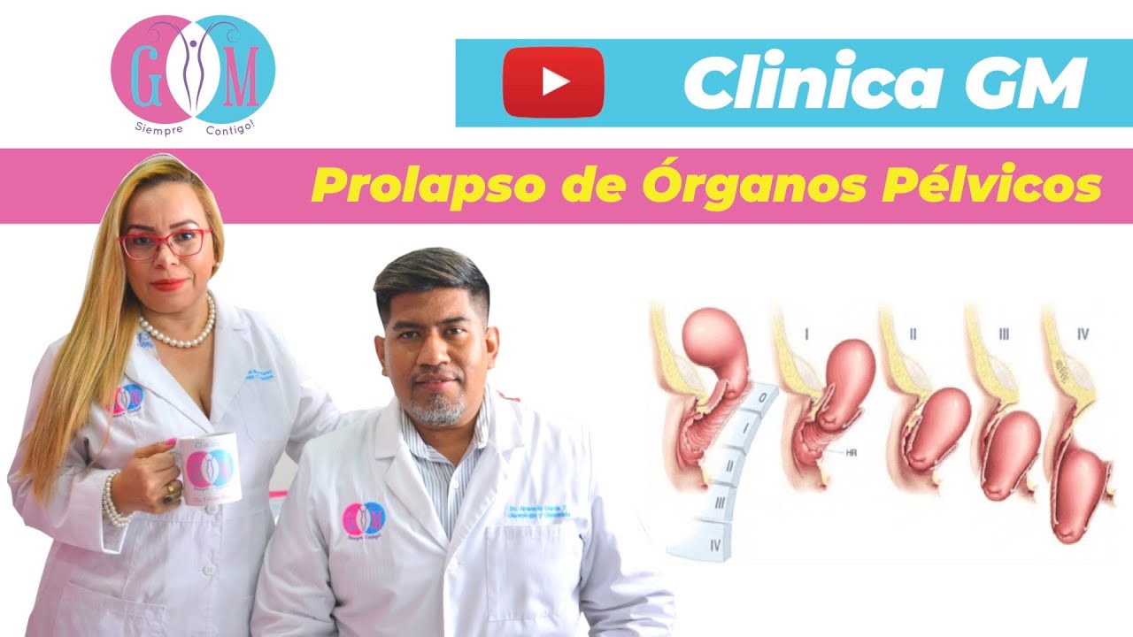 Prolapso de Órganos Pélvicos - YouTube