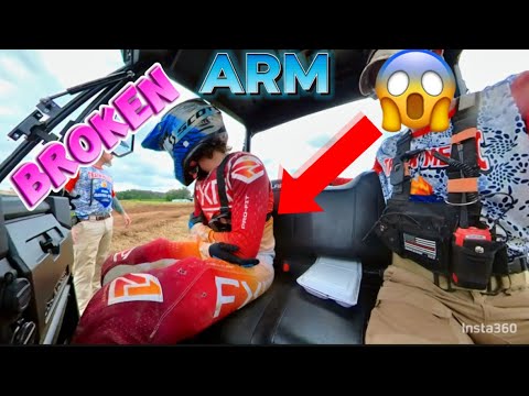 Broken Arm - Diamond Back MX - YouTube