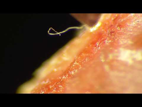 #359 - Cleaning off Morgellons @ Ground 0,  Hot Airing them