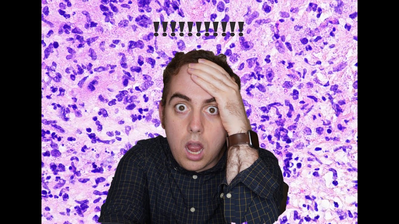 CRAZY Case Files: An Unexpected Diagnosis - YouTube