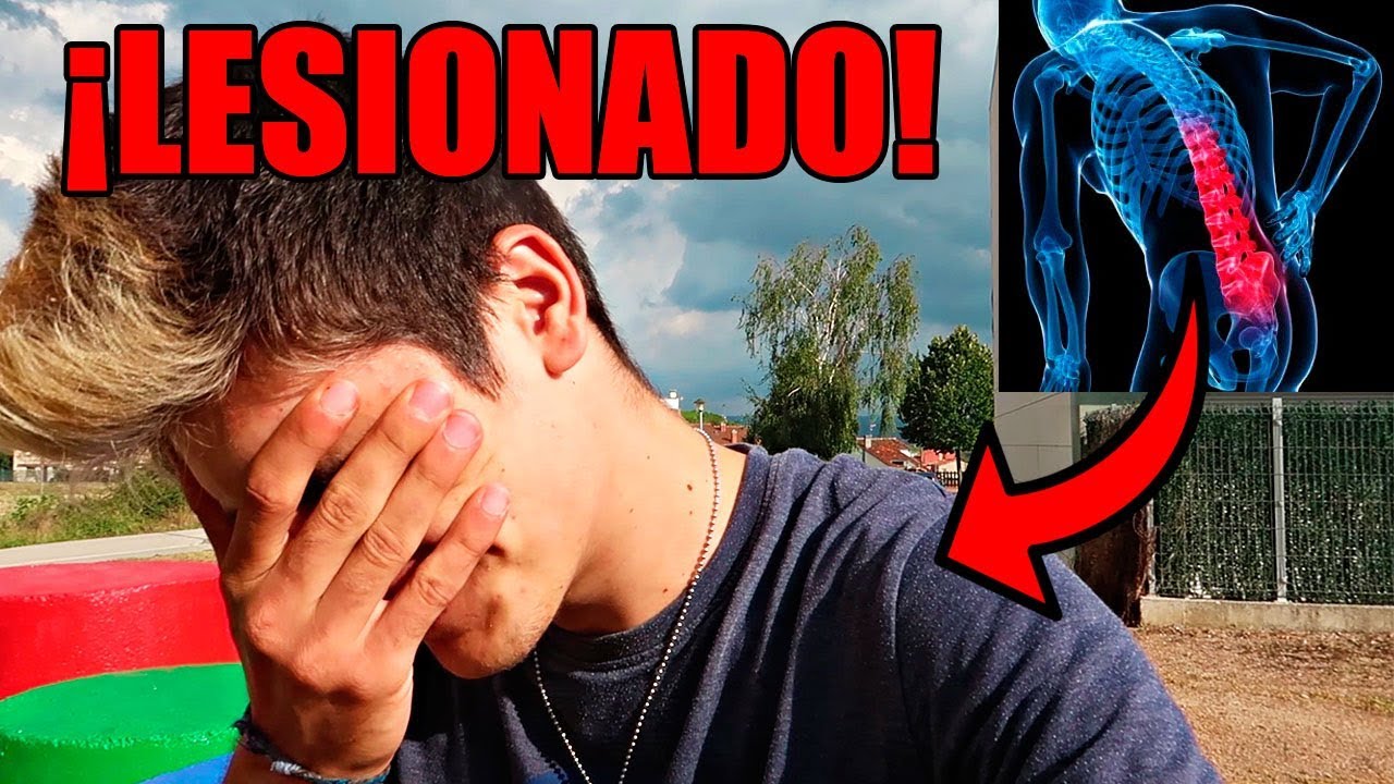 ASÍ FUE MI LESIÓN HACIENDO PARKOUR *MUY DOLOROSO* - YouTube