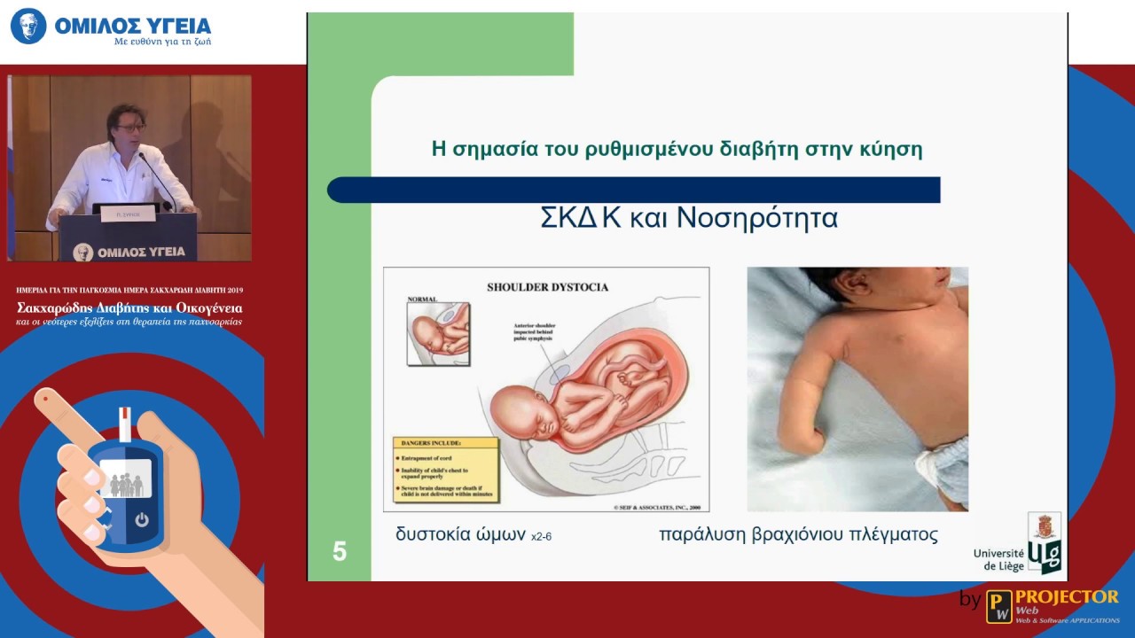 Επίτοκος με Σακχαρώδη Διαβήτη στην αίθουσα τοκετού. Ο προβληματισμός ...