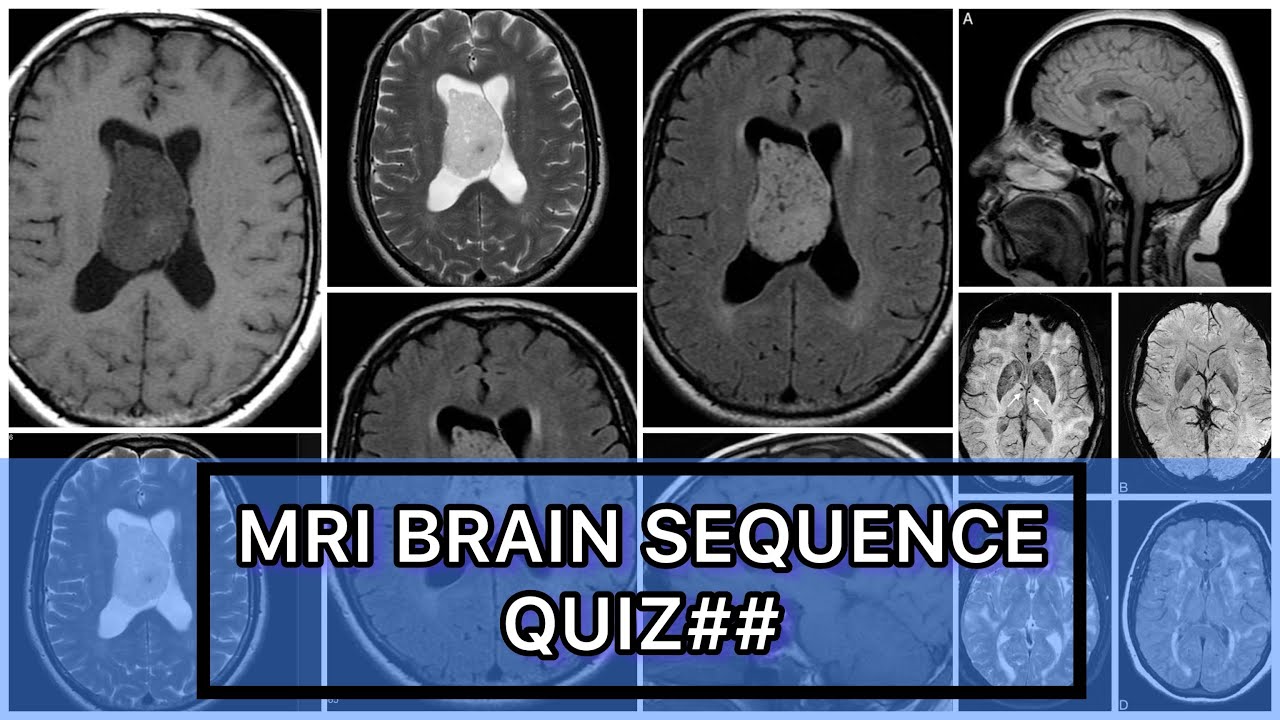 Anatomy Mri Quiz at Don Casteel blog