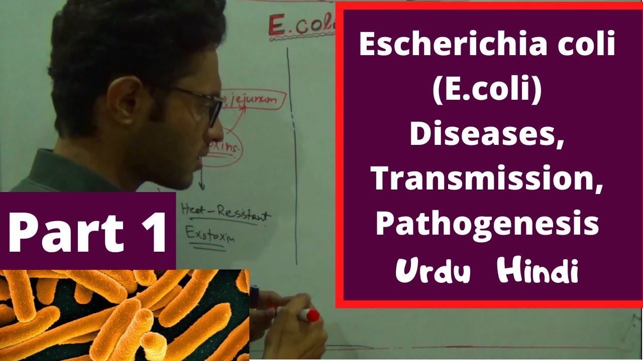 Escherichia coli (E.coli) || Pathogenesis, Transmission and Diseases ...