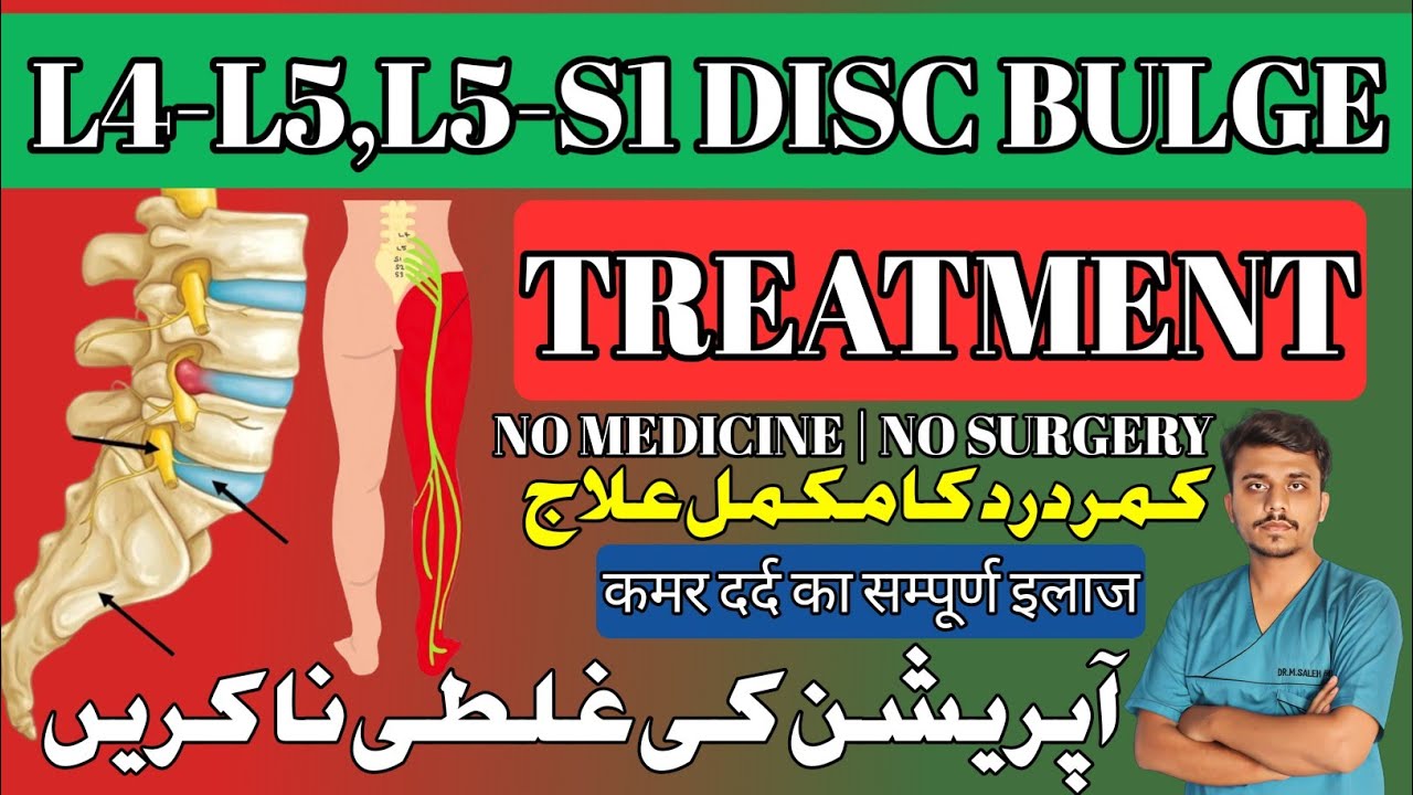 L4-L5 & L5-S1 Disc Bulge and Its Treatment | Low Back And Its Treatment ...