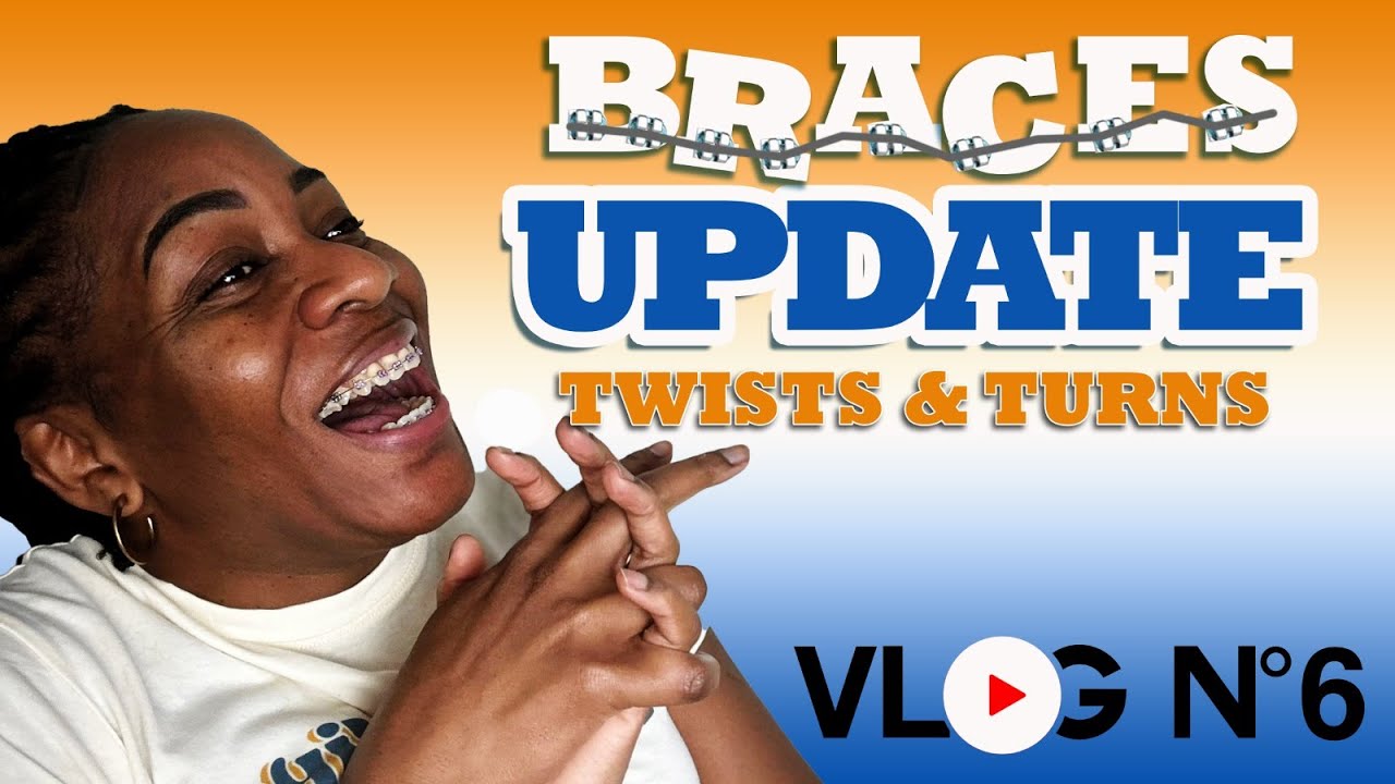 BRACES UPDATE 2024 | FOUR MONTHS LATER | TWISTS & TURNS | VLOG NO 6 ...