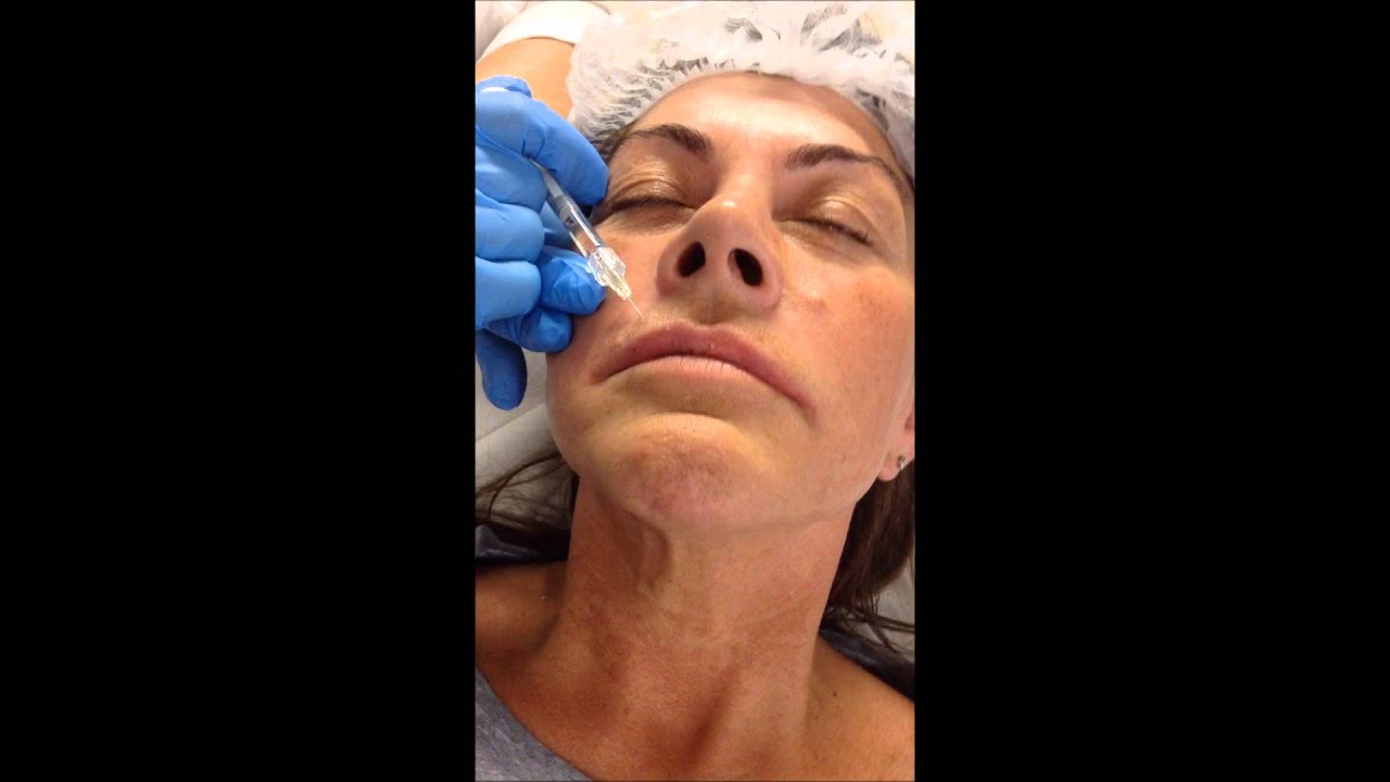 Lip Enhancement Masterclass - YouTube