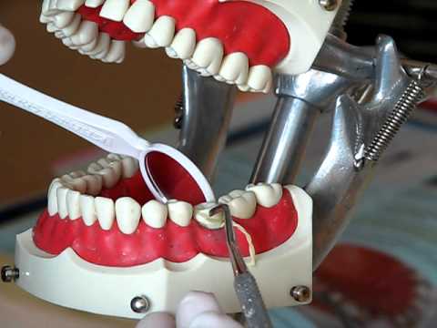 Placement and removal Of Gingival Retraction Cord - YouTube