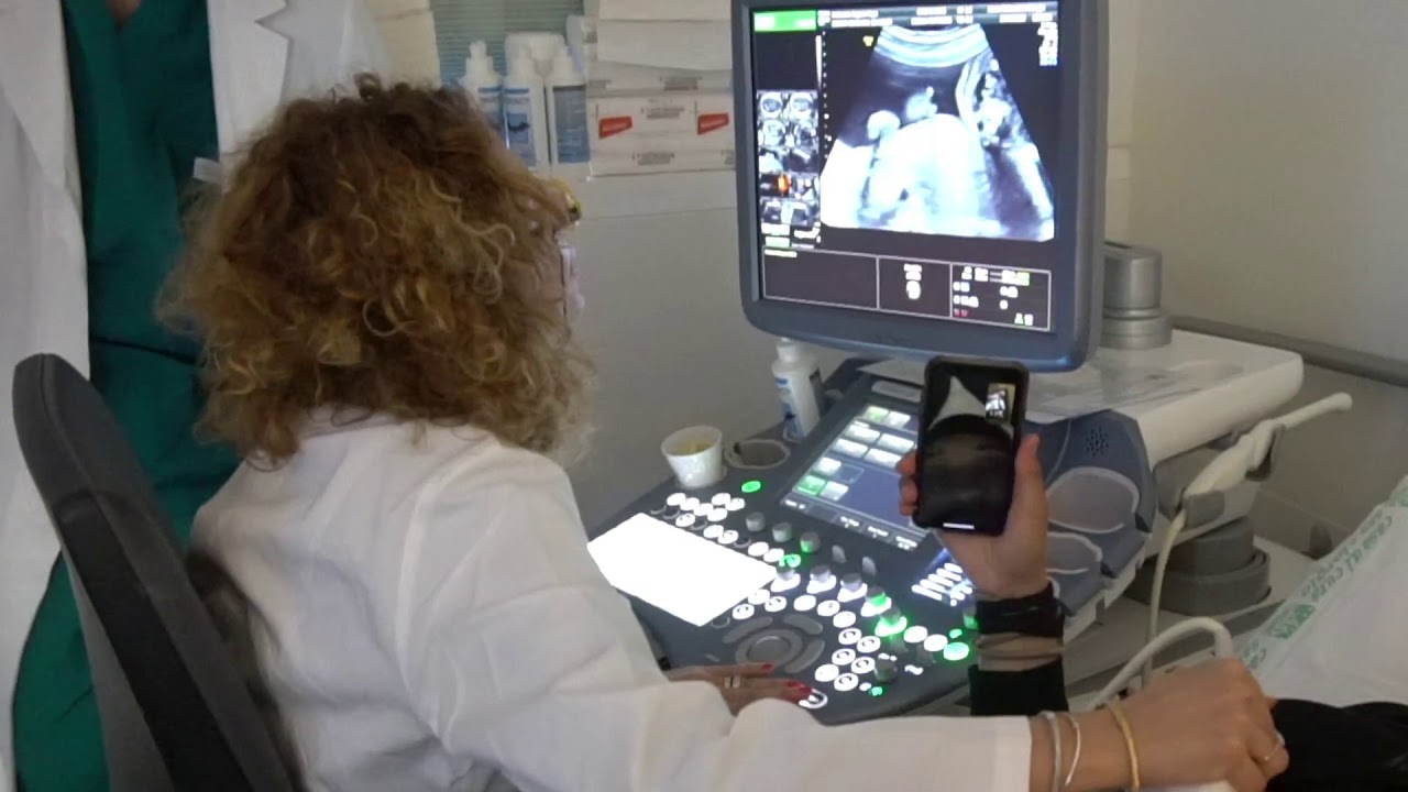 Ultrasound at 5 Months Pregnant | Sonogram in Italy - YouTube