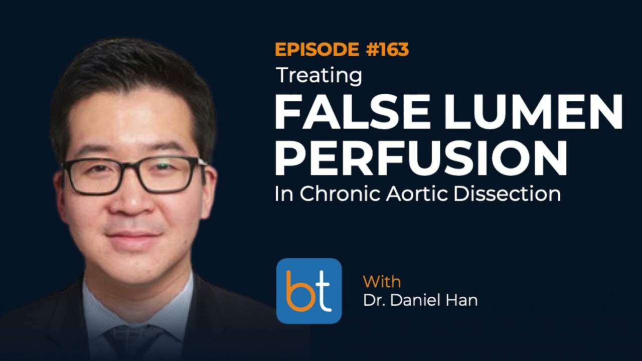 Treating False Lumen Perfusion in Chronic Aortic Dissections w/ Dr ...