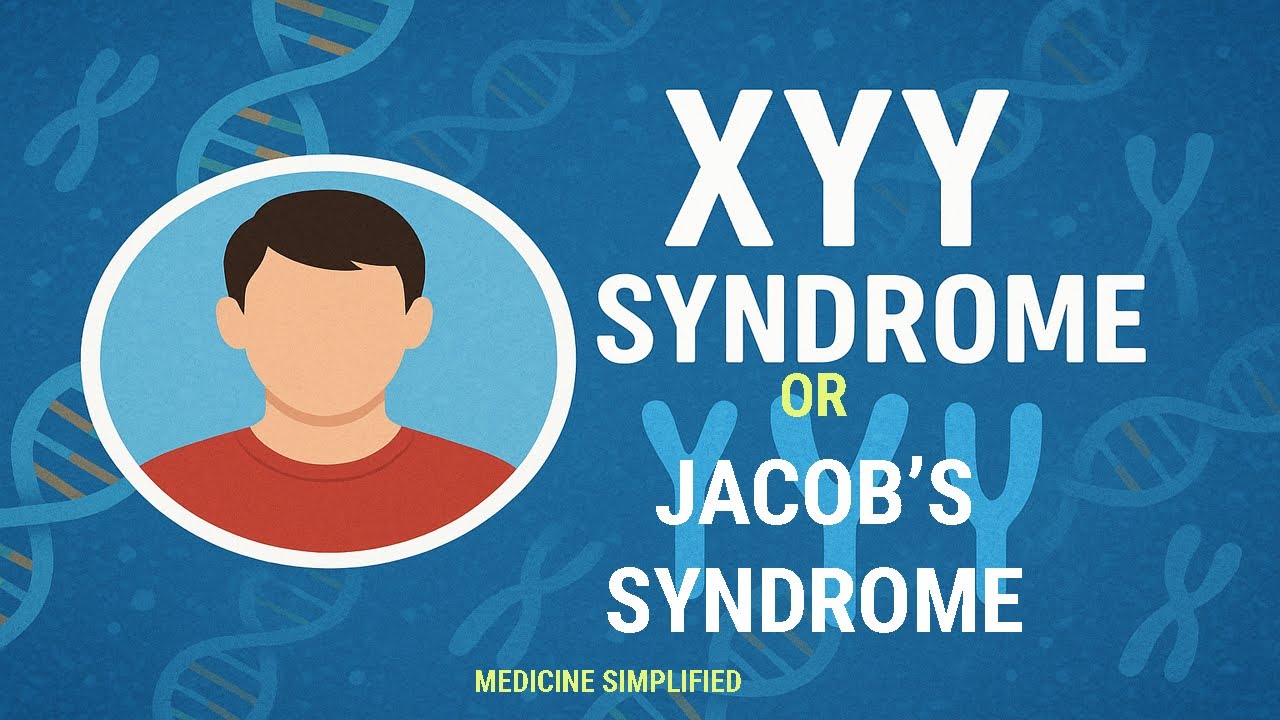 XYY Syndrome (Jacob’s Syndrome) 🧬 : Causes, Symptoms, and Treatment ...