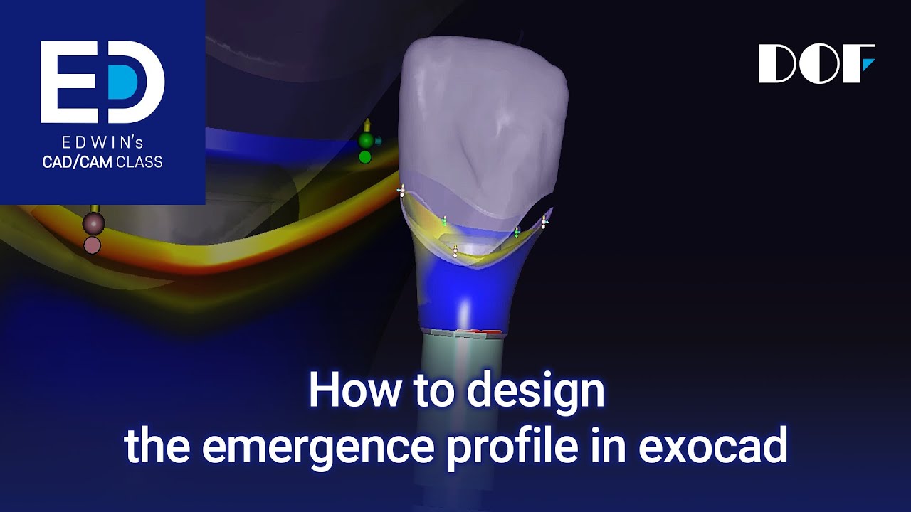 How to design the emergence profile in exocad - YouTube