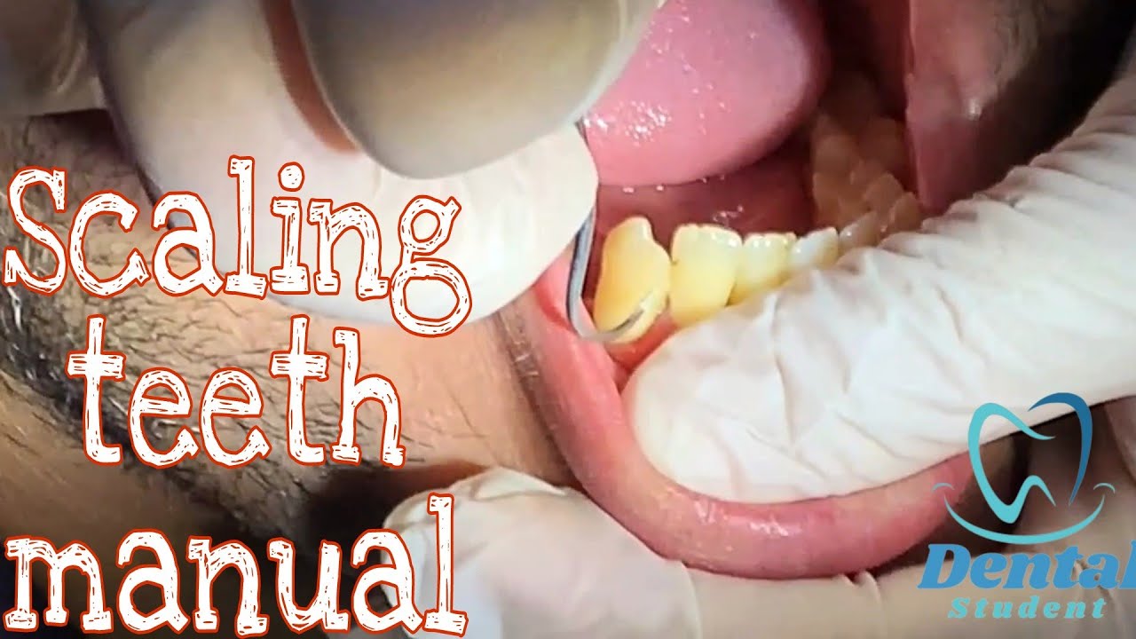 Scaling teeth manual || Instruments شرح عربي بسيط - YouTube