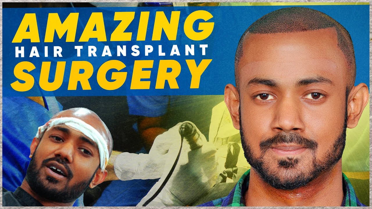 Hair Transplant In Vijayawada Best Results Cost Of Hair Transplant hair-transplant-in-vijayawada-best-results-cost-of-hair-transplant