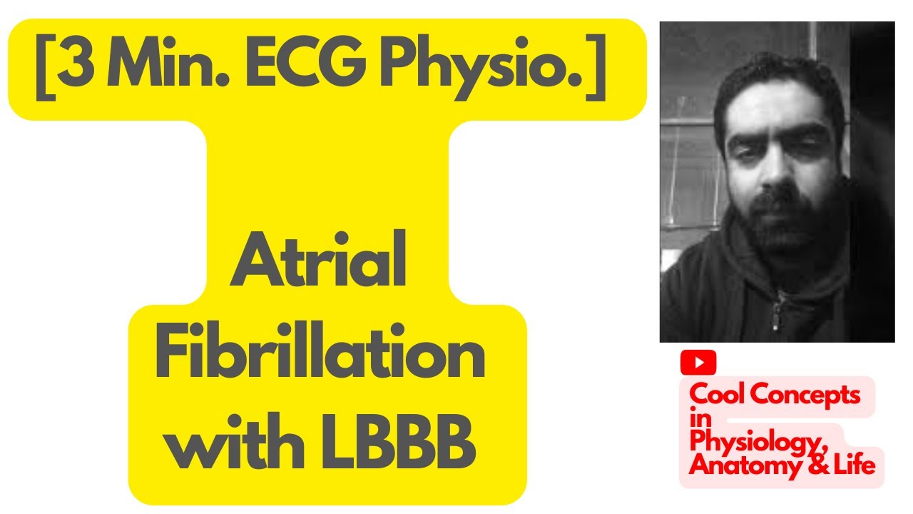How to Spot Atrial Fibrillation + LBBB on ECG FAST! #ECGInterpretation ...