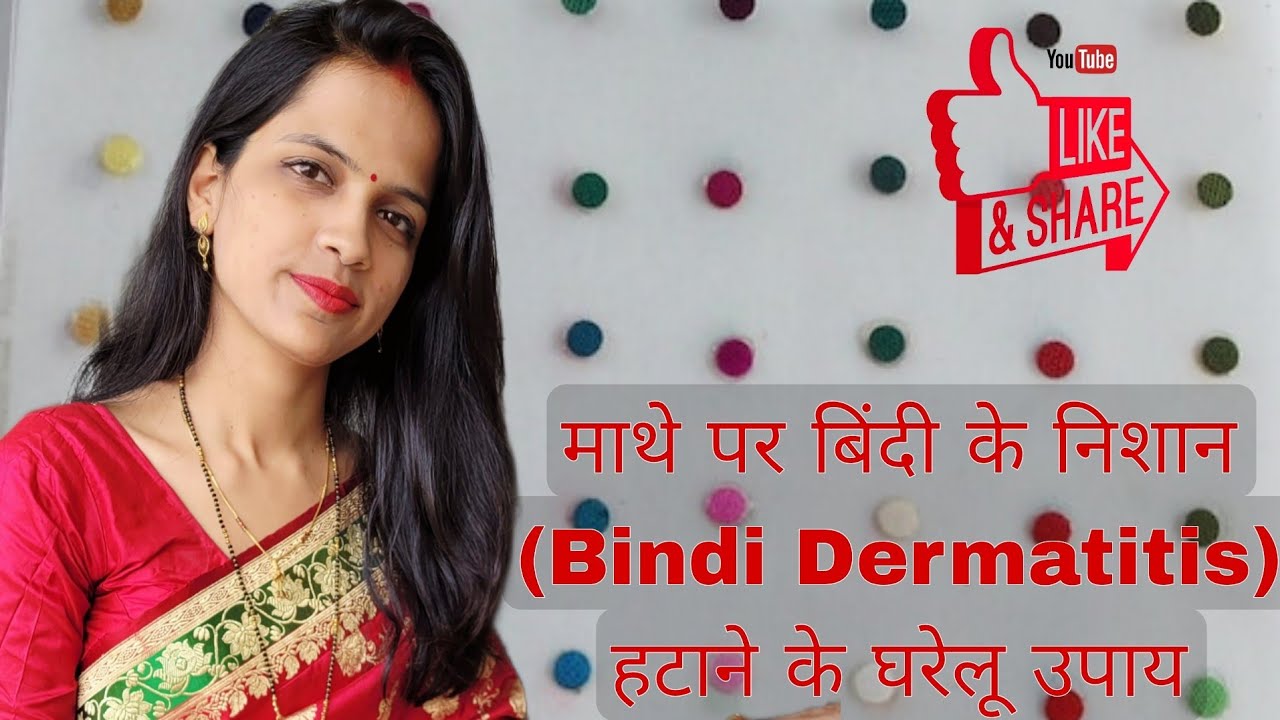 माथे पर बिंदी के निशान (bindi dermatitis) हटाने के घरेलू उपाय |How to ...