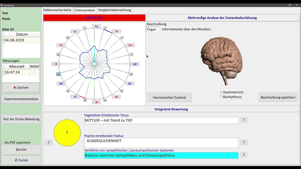 MONICOR 2 - Diff. Diagnose - YouTube