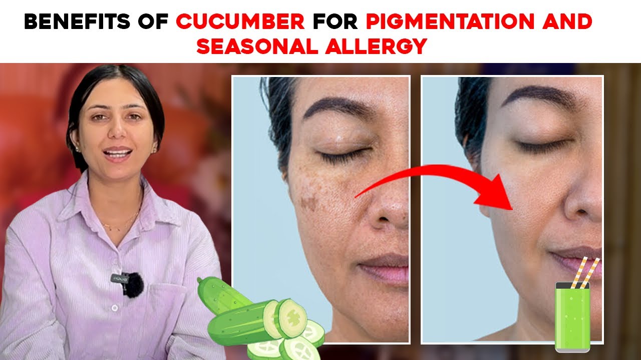 Skin & Health Benefits of Cucumber | Remedies for Pigmentation ...