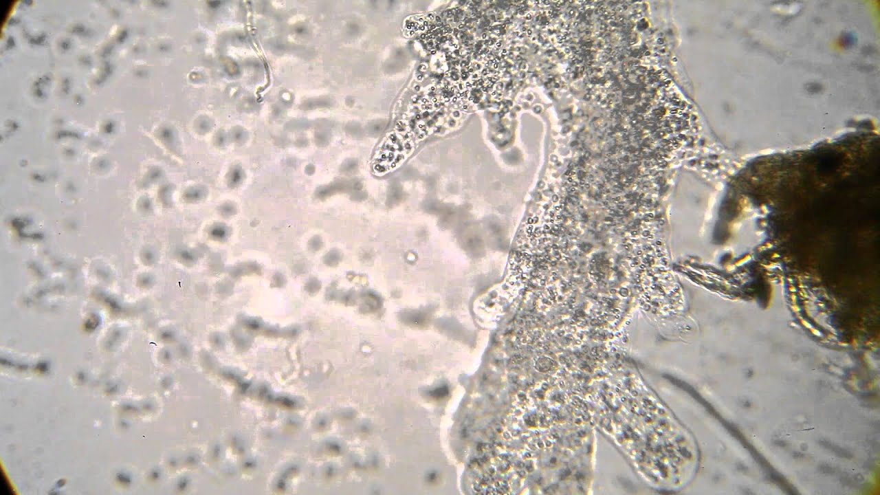 Microscope - Fast and Large Amoeba - YouTube