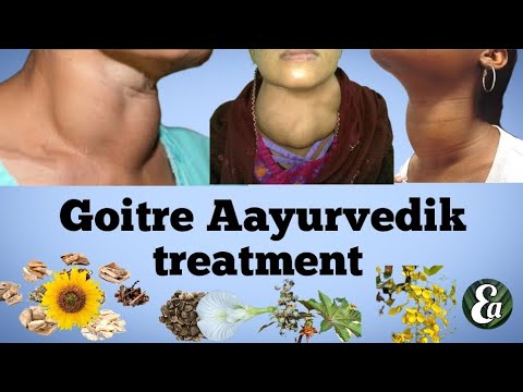 Goitre remedy | goiter treatment without surgery - YouTube