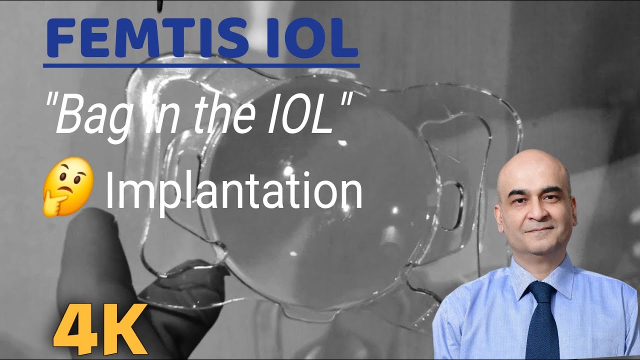 "BAG IN THE IOL" Unique FEMTIS IOL implantation in 4K resolution ...